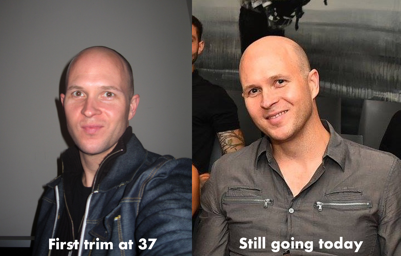 The Biggest Life Lesson I Learned from Going Bald. | elephant journal